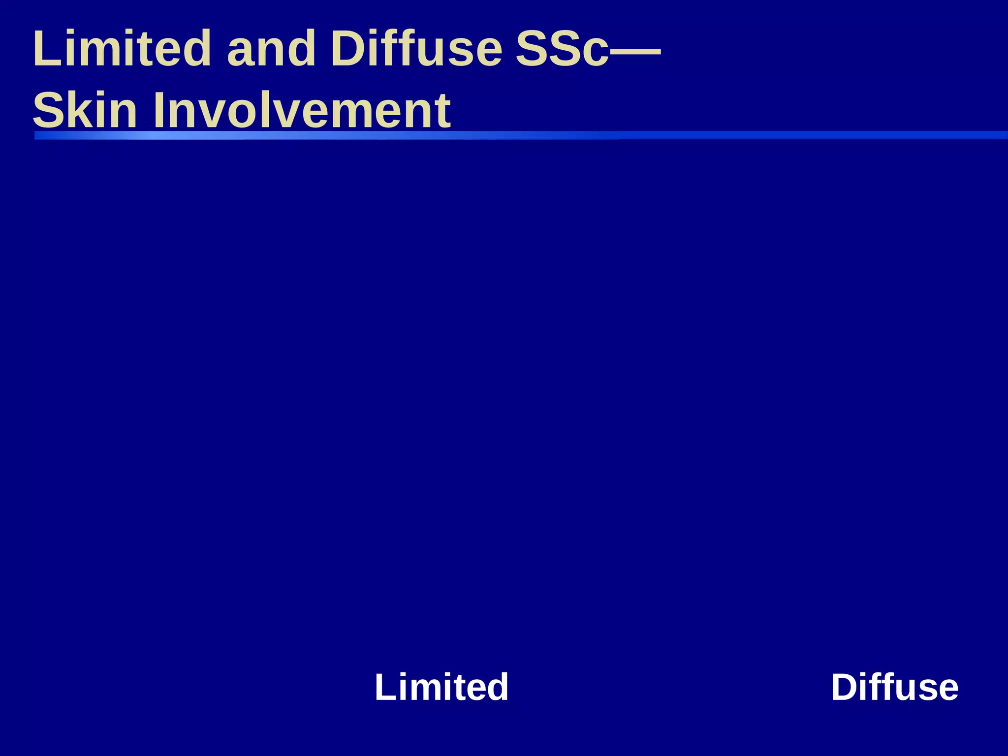 Overview of Scleroderma | PPT