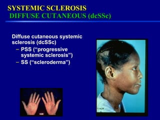 Overview of Scleroderma | PPT | Lung and Respiratory Health | Diseases ...