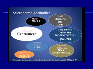 Overview of Scleroderma | PPT
