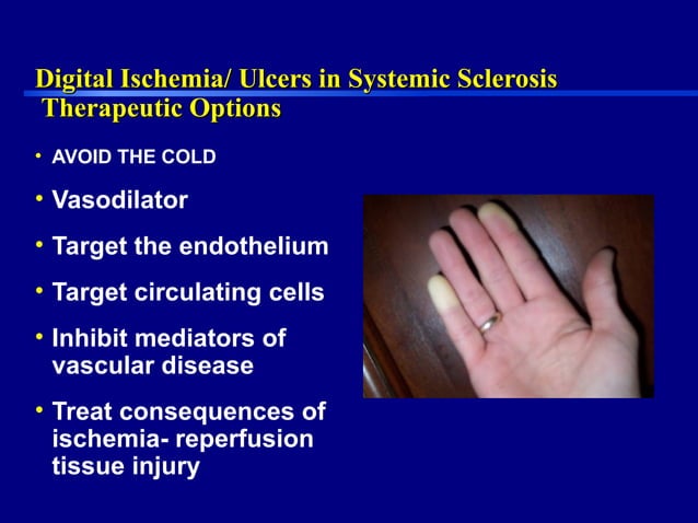 Overview of Scleroderma | PPT | Lung and Respiratory Health | Diseases ...