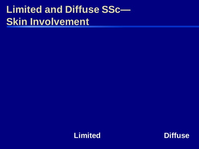 Overview of Scleroderma | PPT | Lung and Respiratory Health | Diseases ...