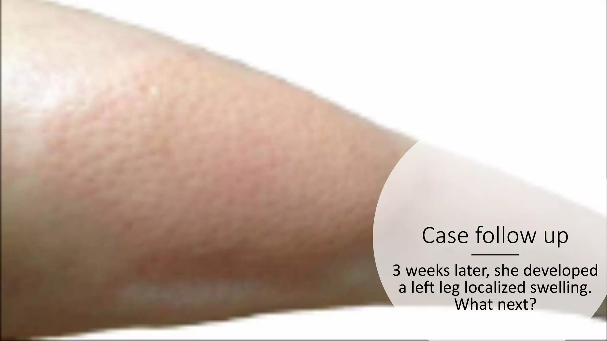 Swelling..swelling ( angioedema approach ) Ahmed Yehia, MD internal ...