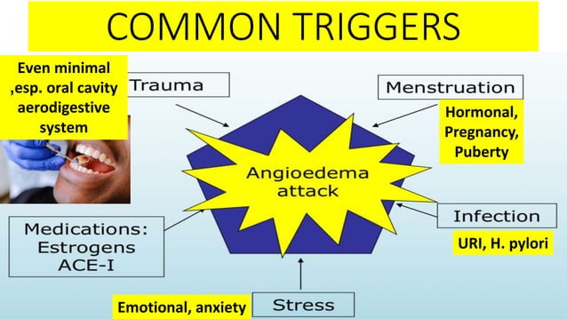 Swelling..swelling ( angioedema approach ) Ahmed Yehia, MD internal ...