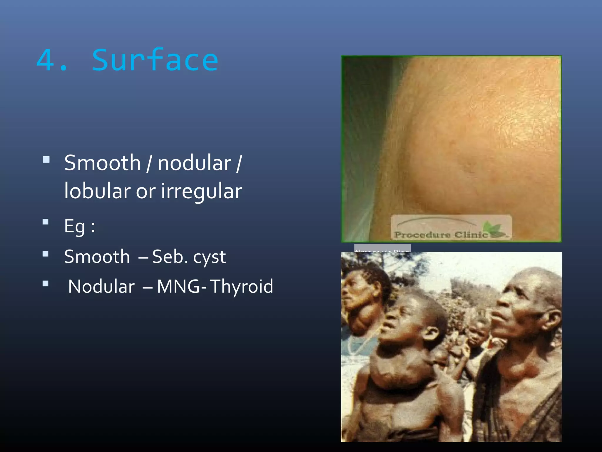 Swelling - Examination | PPT