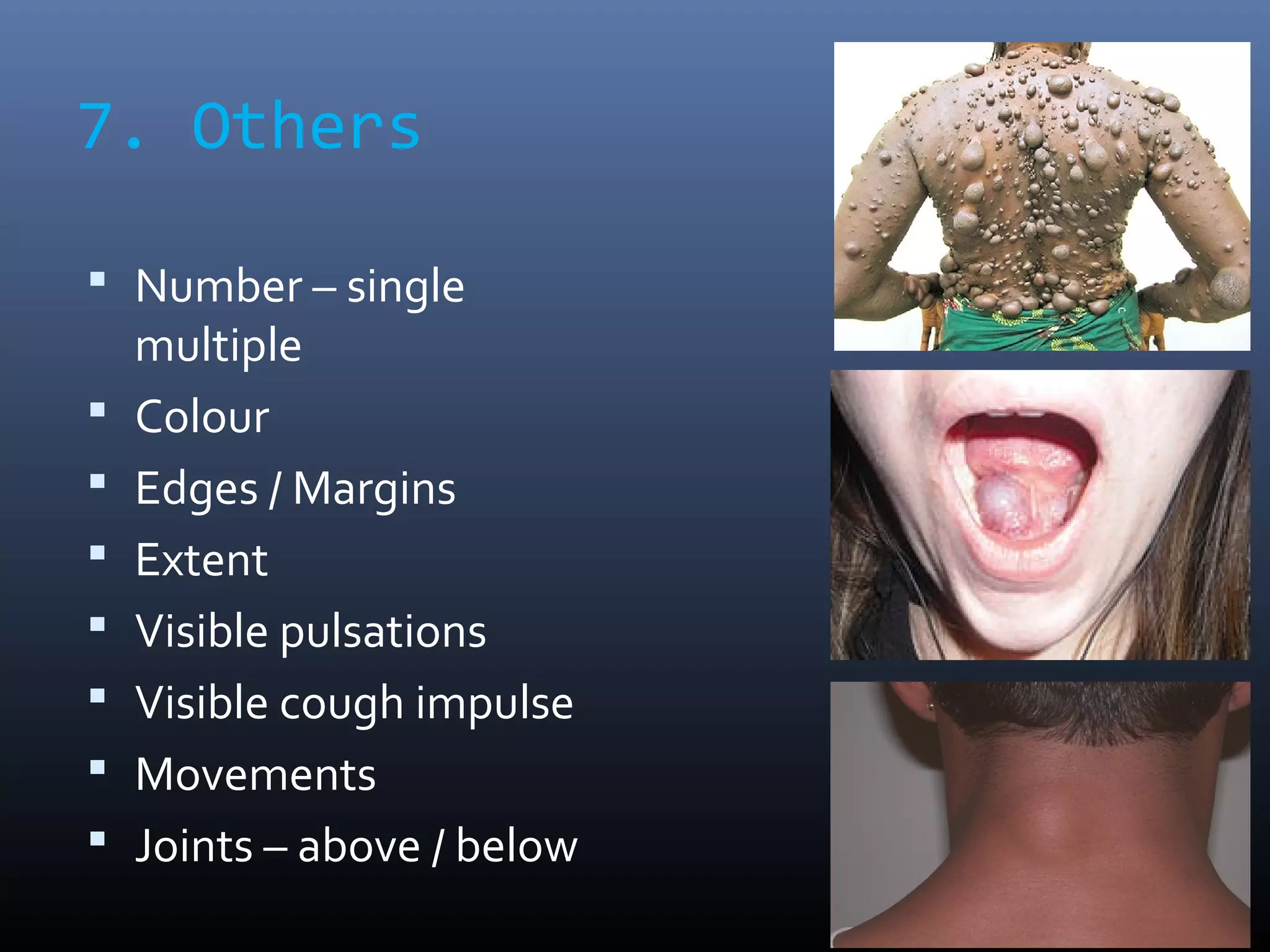 Swelling - Examination | PPT