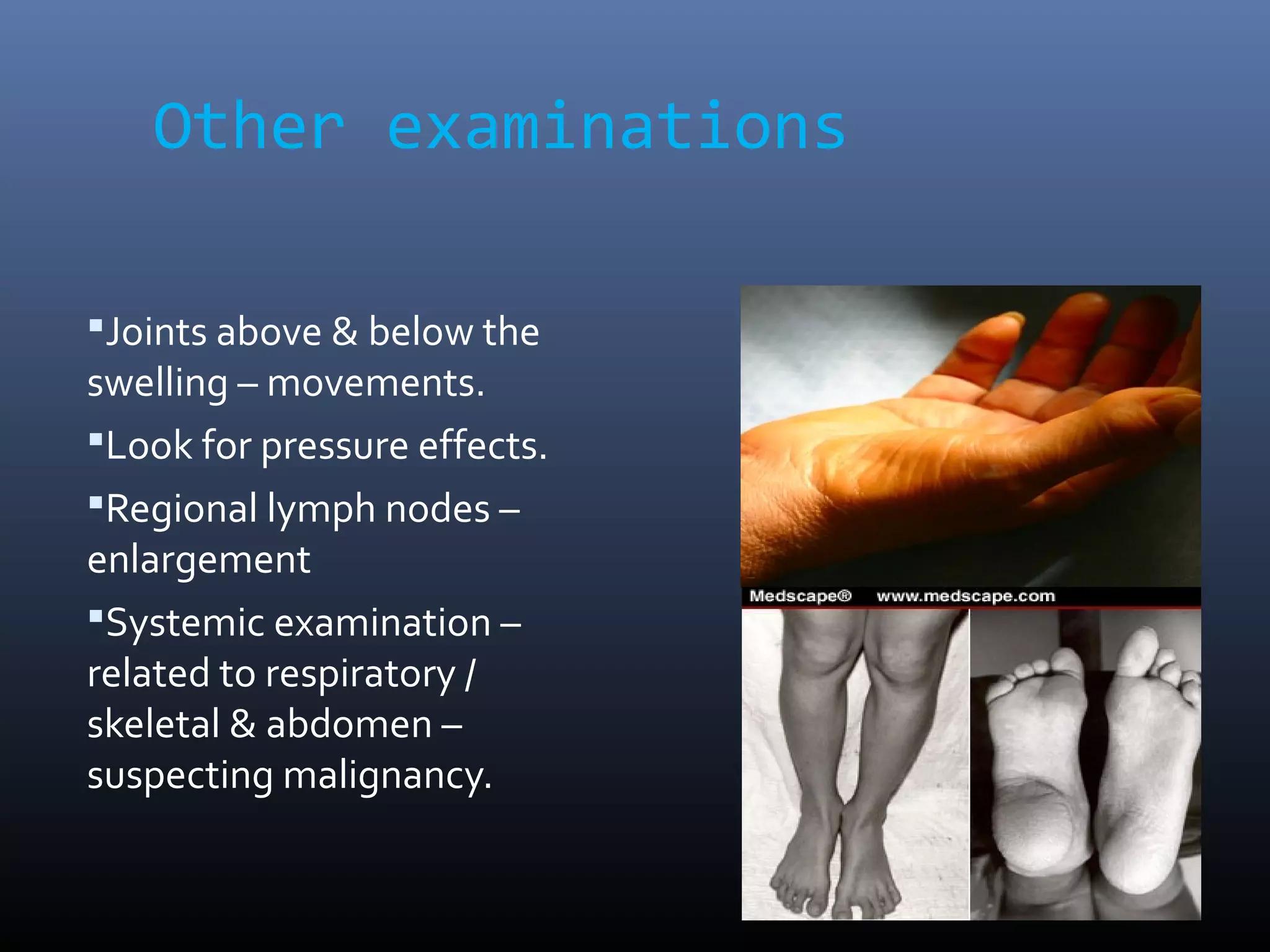 Swelling - Examination | PPT