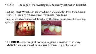 EXAMINATION of swellings of the oral cavity | PPTX