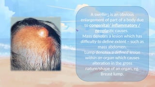 Investigations of swelling surgery .pptx