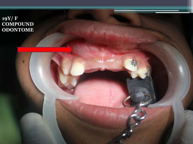 Swellings of the jaw | PPTX | Dental Health | Diseases and Conditions
