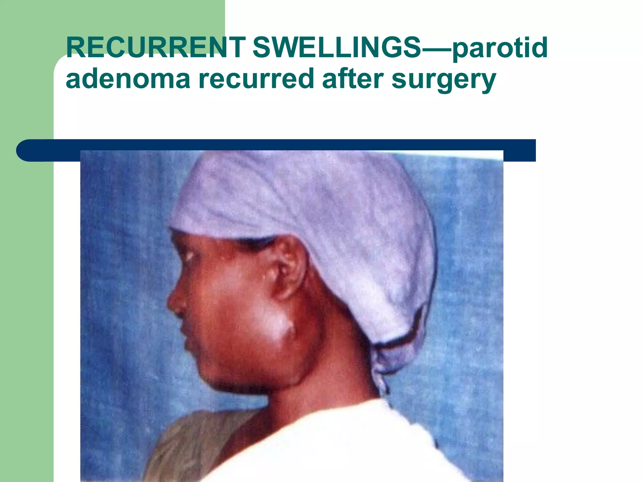 Clinical examination of swelling | PDF