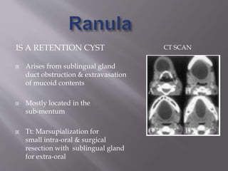 Swellings of neck | PPTX