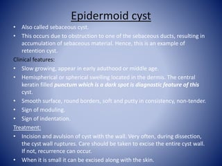 Swellings, tumours and cysts | PPTX
