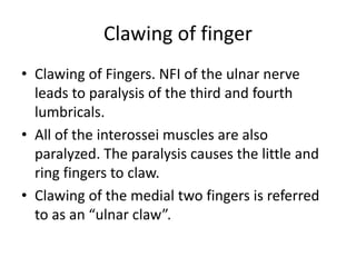 Leprosy & its pt management | PPTX