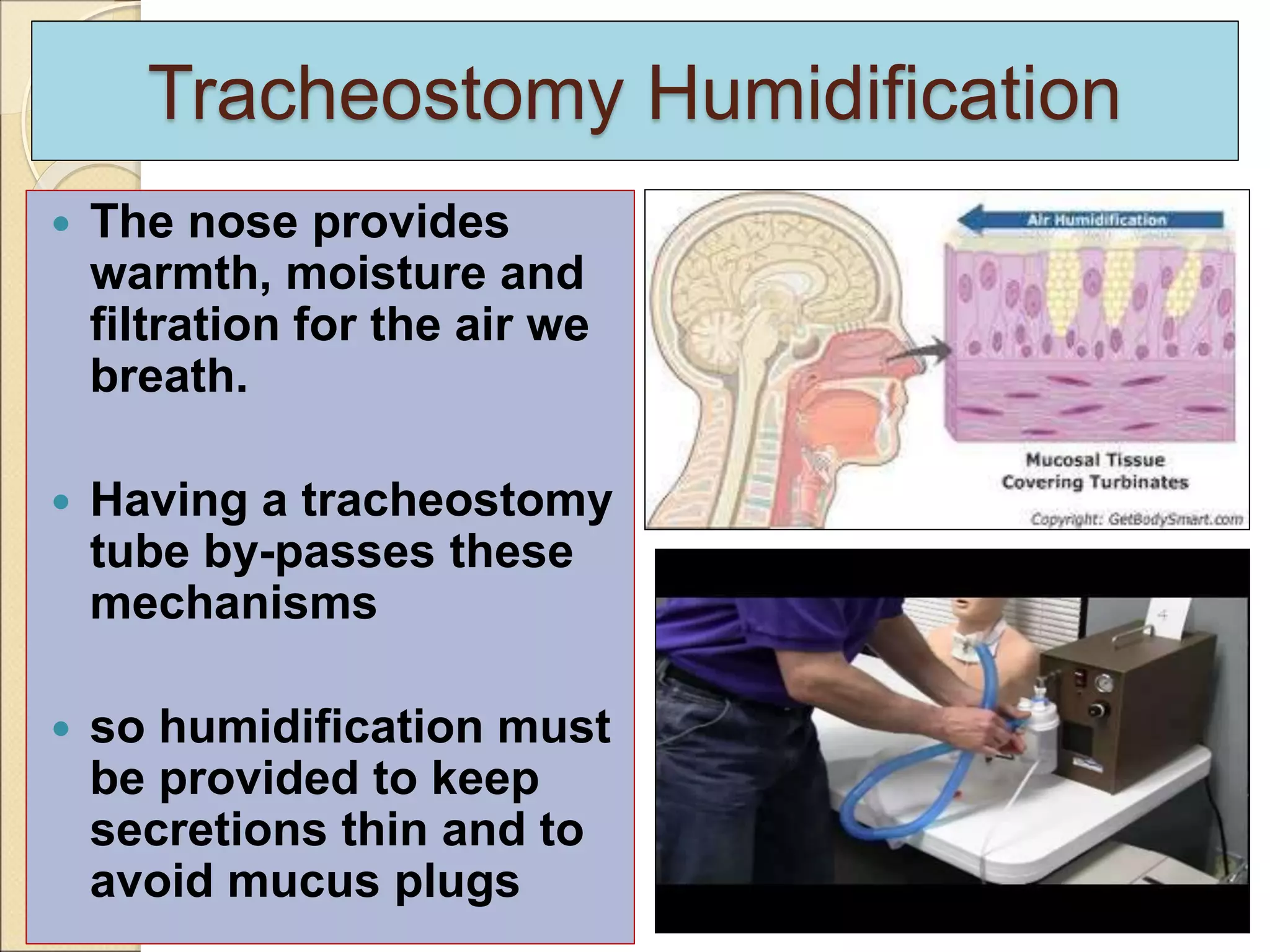Tracheostomy | PPT