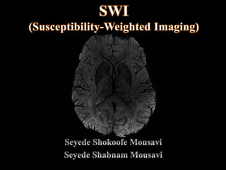 SWI for radiation technologists | PPT