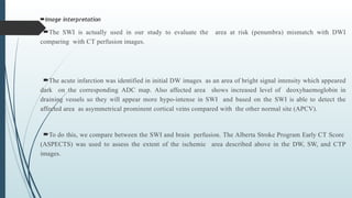 swi compare to ctp in acute infarct-JC.pptx