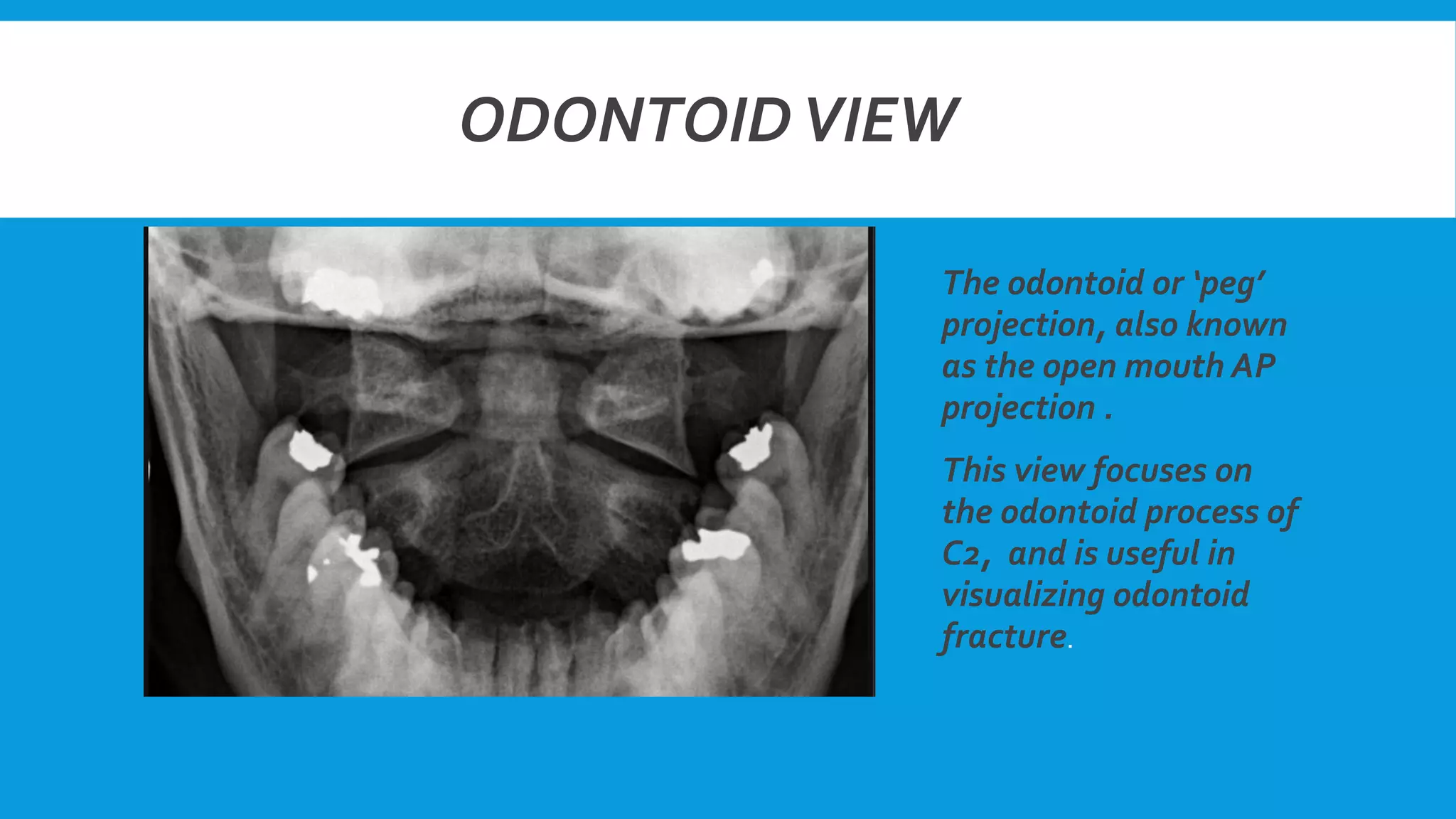 Swimmer’s view.pptx