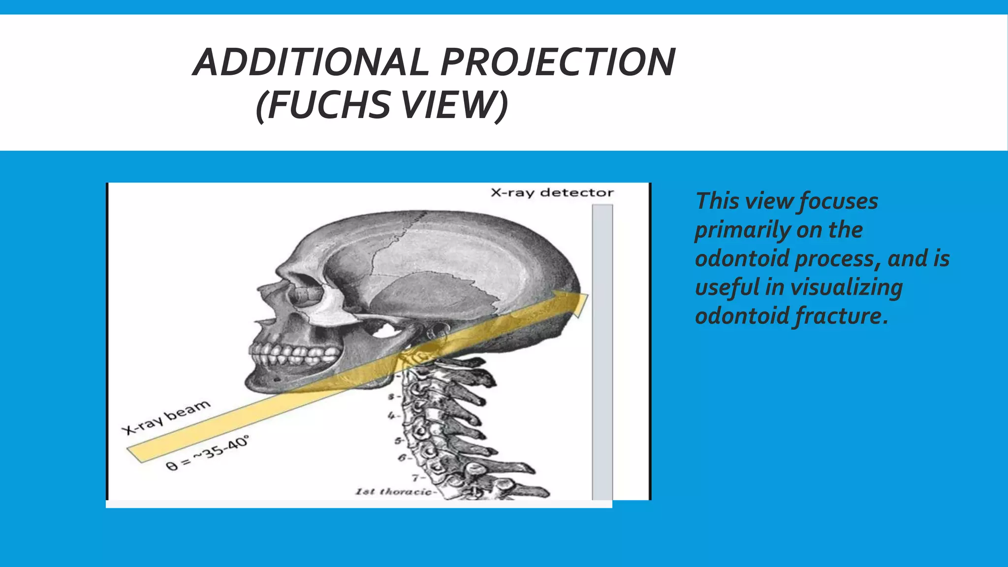 Swimmer’s view.pptx