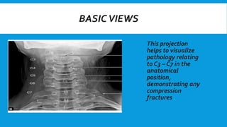 Swimmer’s view.pptx