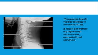 Swimmer’s view.pptx