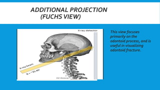 Swimmer’s view.pptx