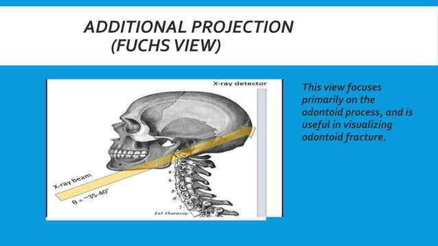 Swimmer’s view.pptx