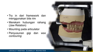 Swinglock Gigi Tiruan Sebagian Kerangka Logam | PPTX