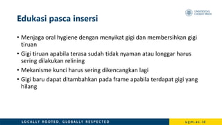 Swinglock Gigi Tiruan Sebagian Kerangka Logam | PPTX