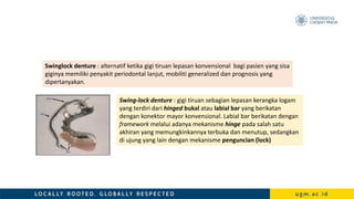 Swinglock Gigi Tiruan Sebagian Kerangka Logam | PPTX