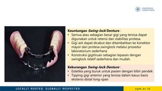 Swinglock Gigi Tiruan Sebagian Kerangka Logam | PPTX