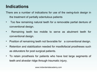 Swing lock partial denture/ oral surgery courses | PPT