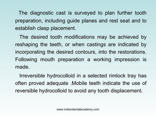 Swing lock partial denture/ oral surgery courses | PPT
