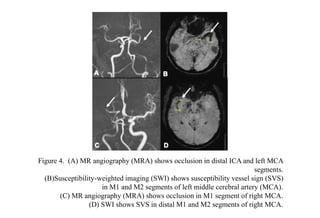 SWI presentation.pptx