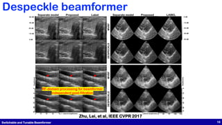 Switchable and tunable deep beamformer using adaptive instance normalization for medical ...