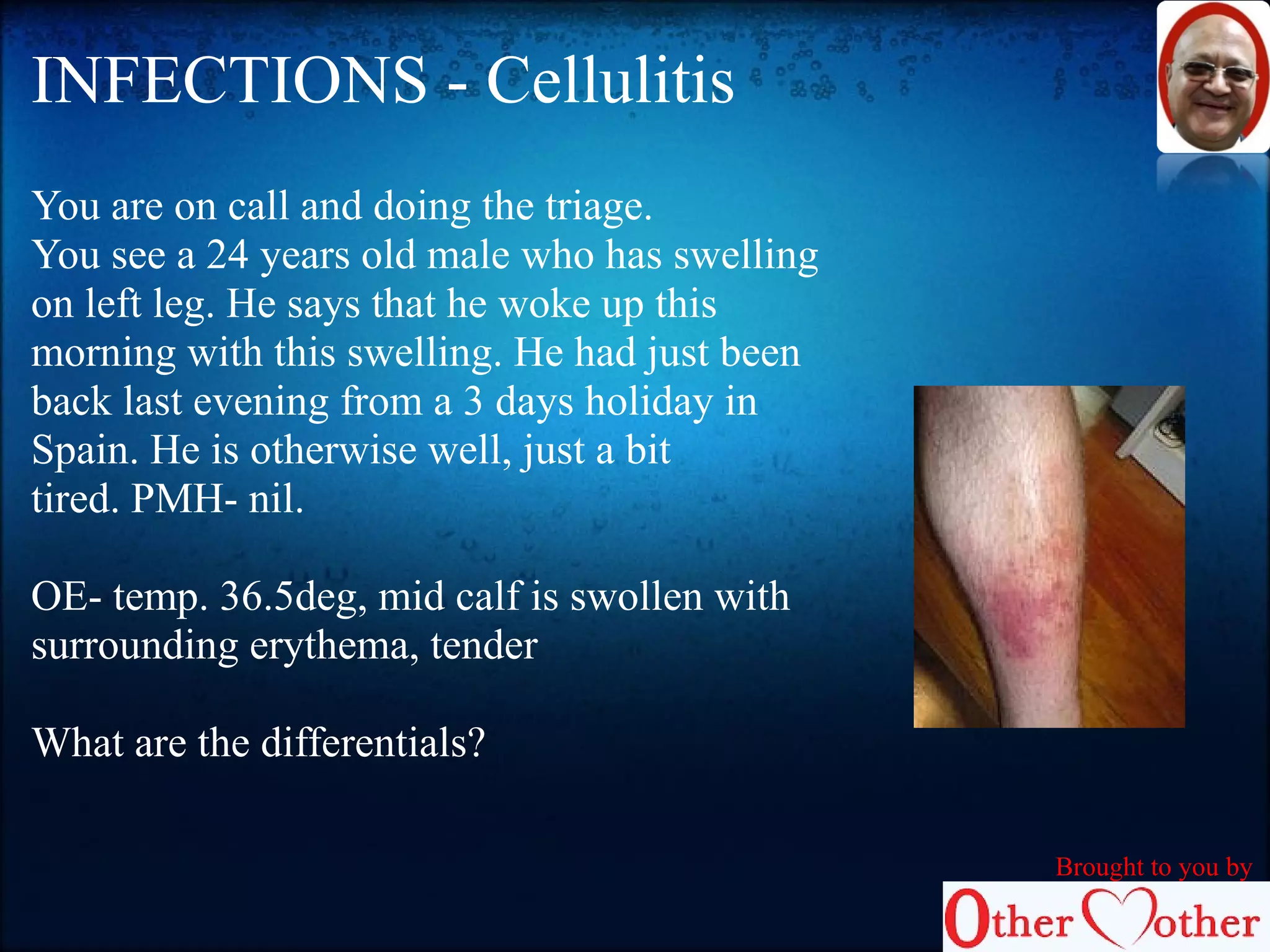Swollen legs | PPT