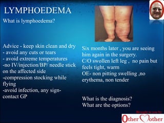 Swollen legs | PPT