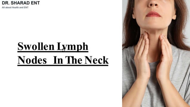 Swollen Lymph Nodes In The Neck-Dr. Sharad ENT | PPT