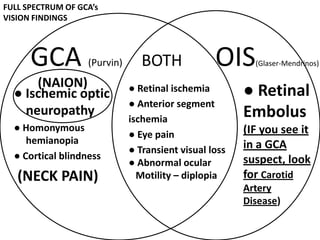 Swollen optic nerve_presentation_last_revision 103112 disregard all ...