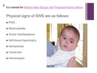 Weber Syndrome Symptoms