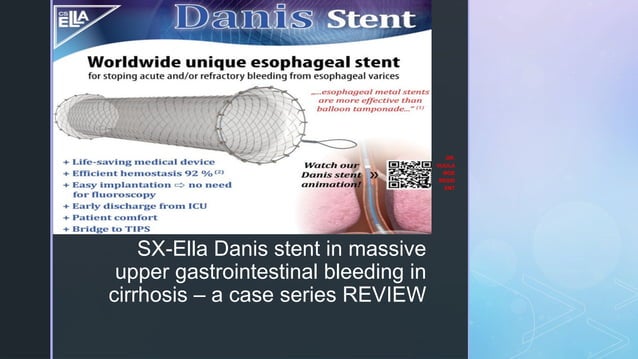 SX-Ella Danis stent in massive upper gastrointestinal bleeding.pptx