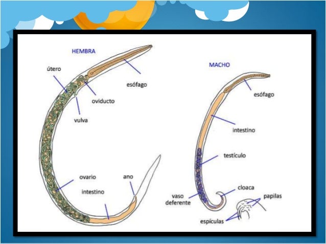 Sindrome de Loeffler