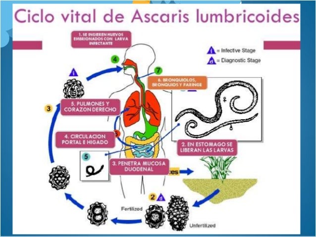 Sindrome de Loeffler