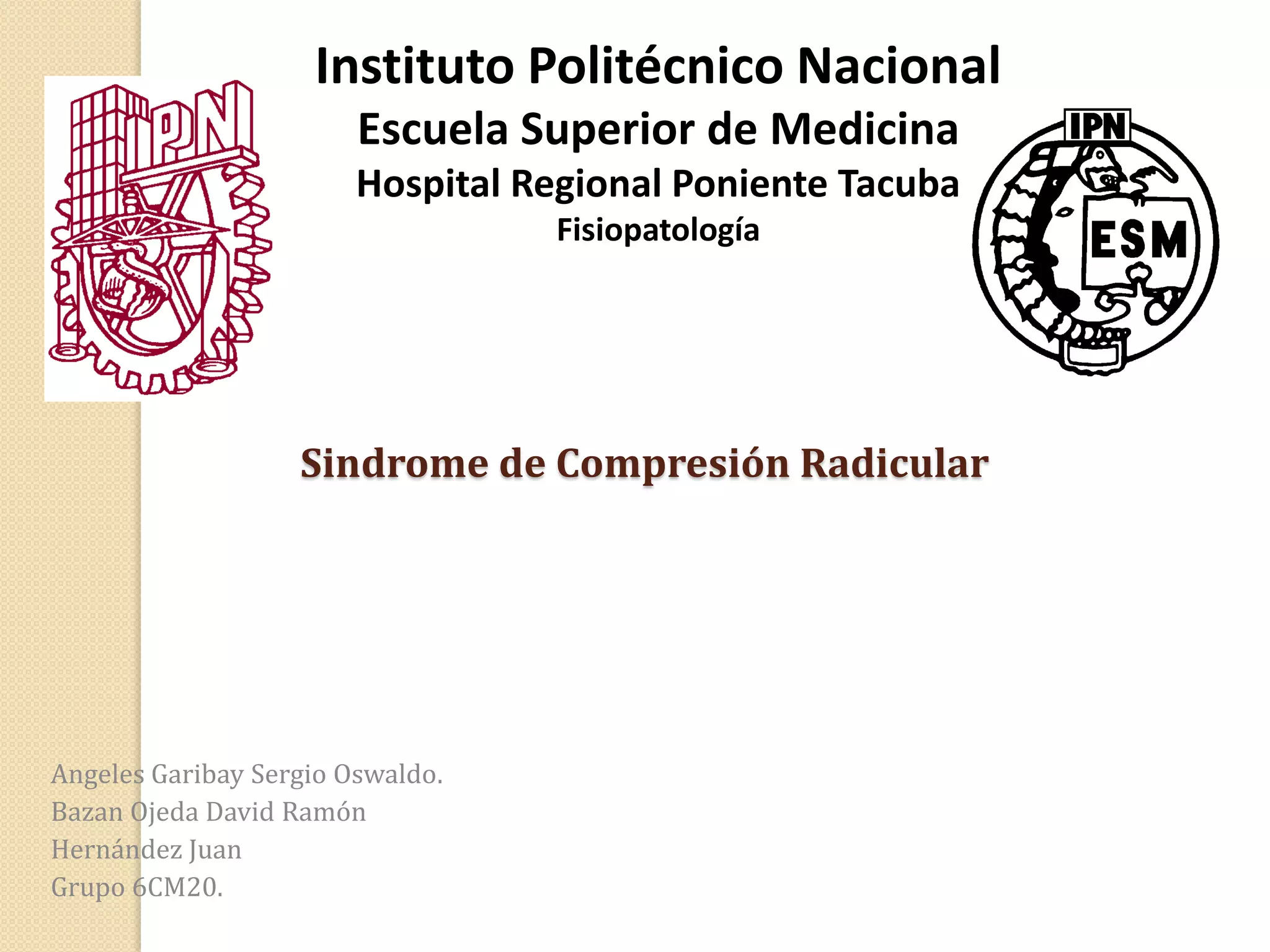 Síndrome de Compresión Radicular | PPTX