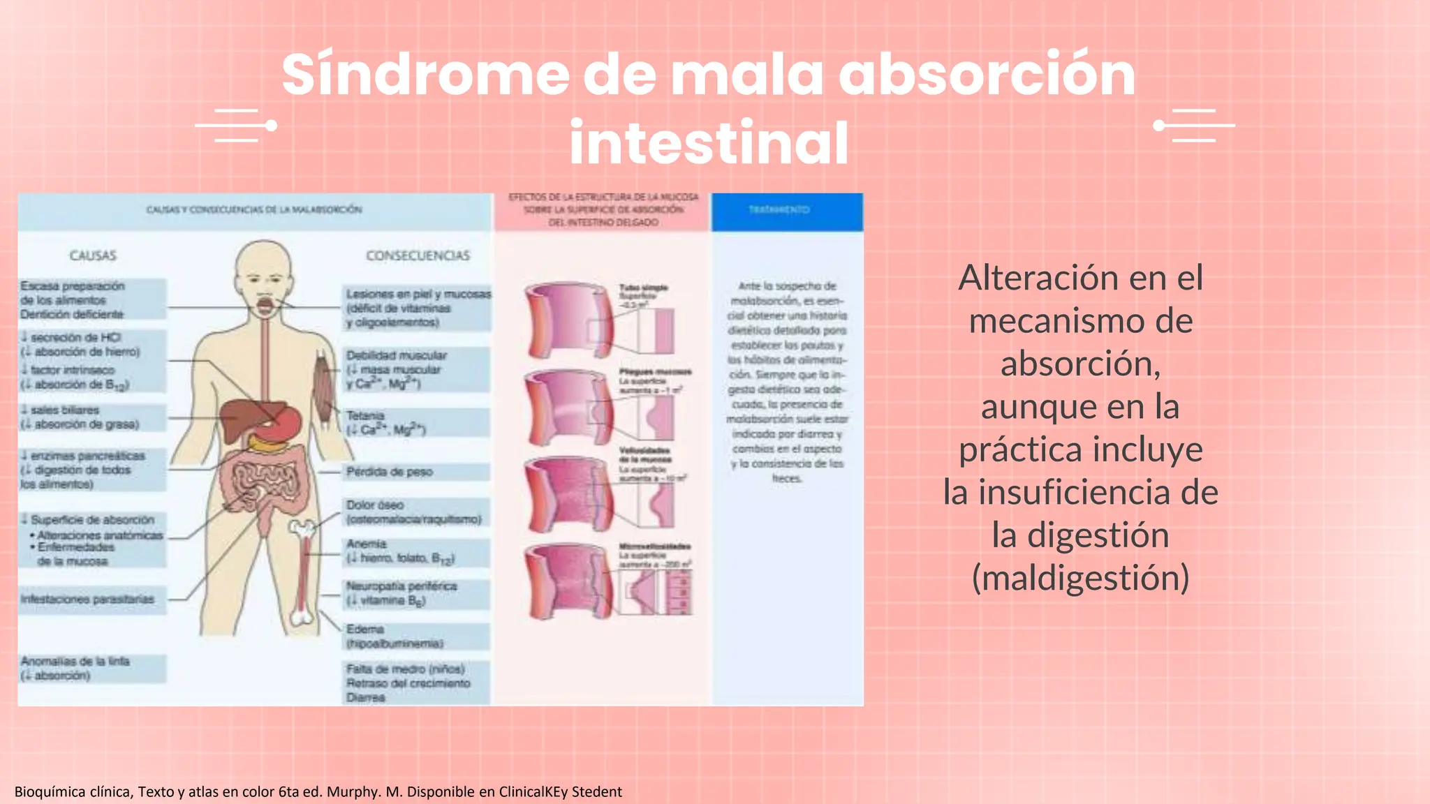MEDICINA INTERNA SINDROME DE MALA ABSORCION INTESTINAL | PPTX