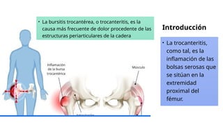 presentacion de sx doloroso de cadera- bursitis .pptx