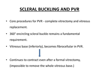 Surgical management of Proliferative Vitreoretinopathy | PPTX | First ...