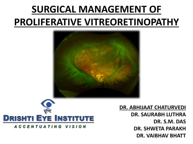 Surgical management of Proliferative Vitreoretinopathy | PPT