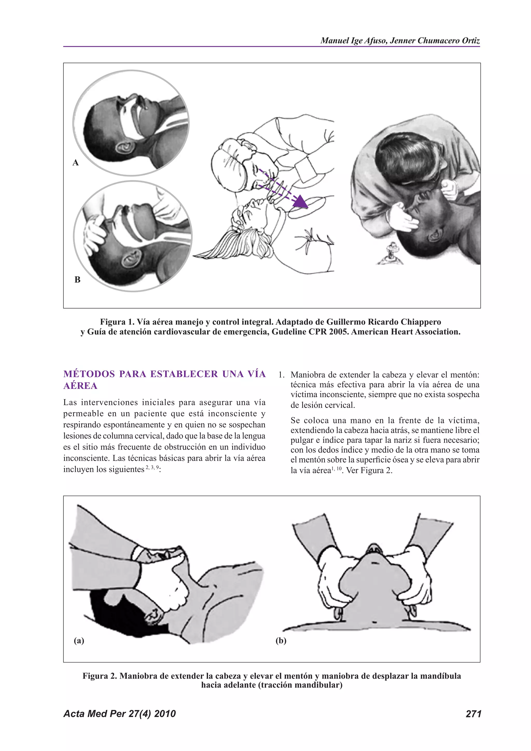 Protocolo intubacion tet | PDF