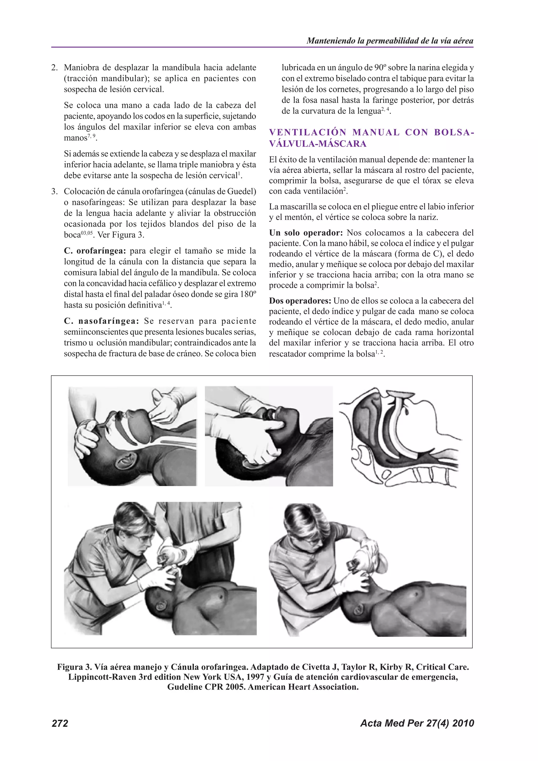 Protocolo intubacion tet | PDF