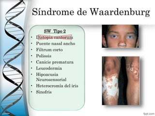 Síndrome de Waardenburg | PPT